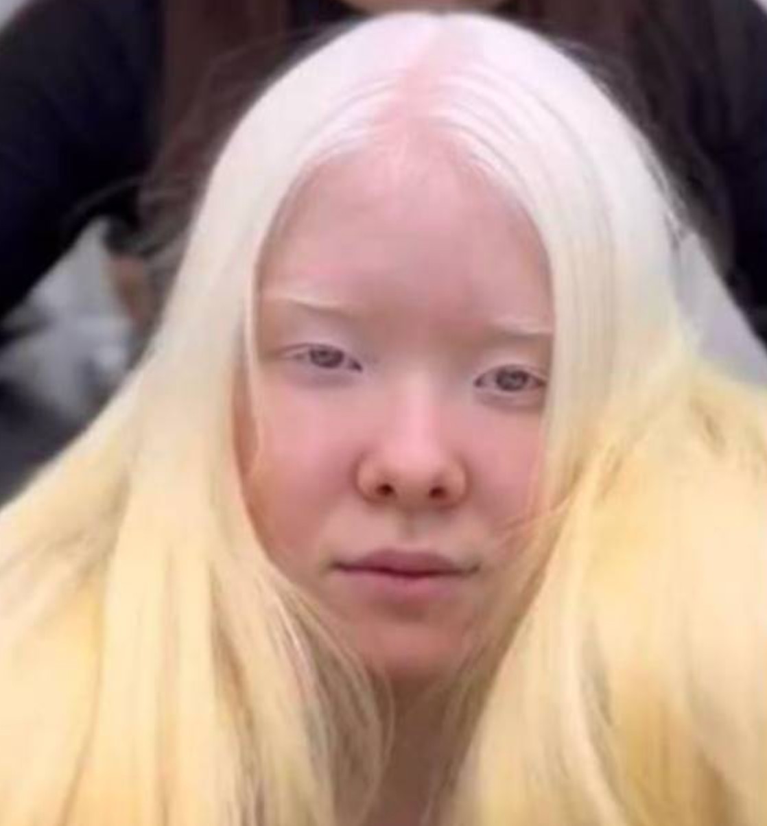 Une transformation étonnante : une jeune femme atteinte d’albinisme a ...