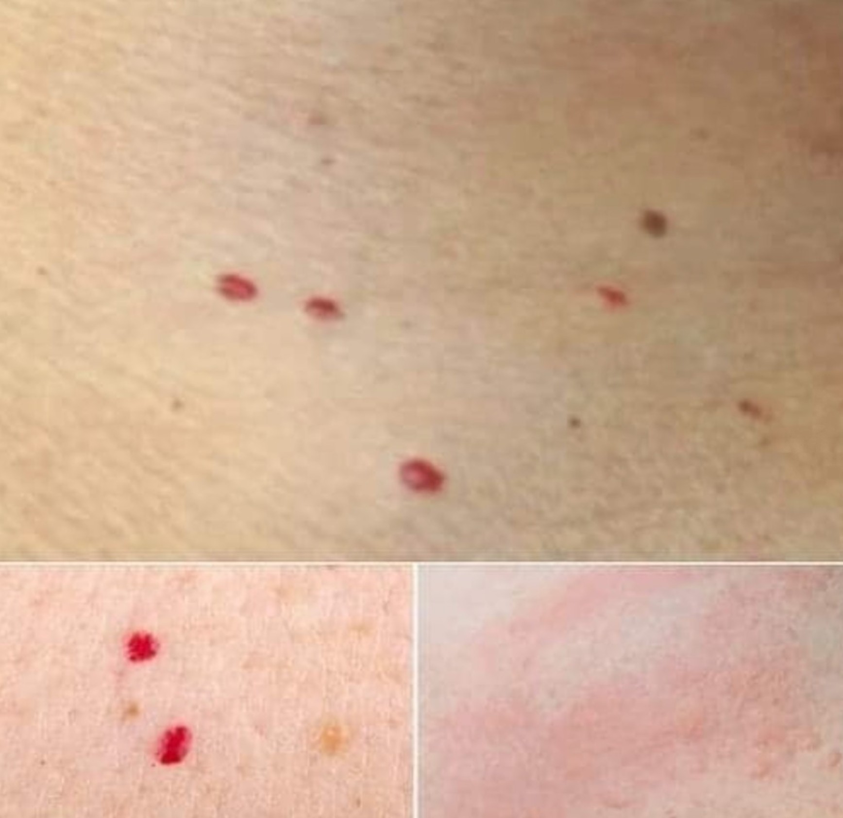 Points rouges soudains sur la peau : causes possibles et signes qui ...